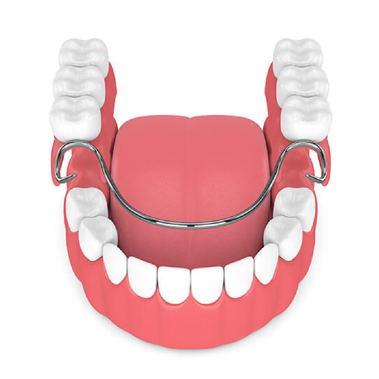 Removable Dentures in Spring TX and Woodlands